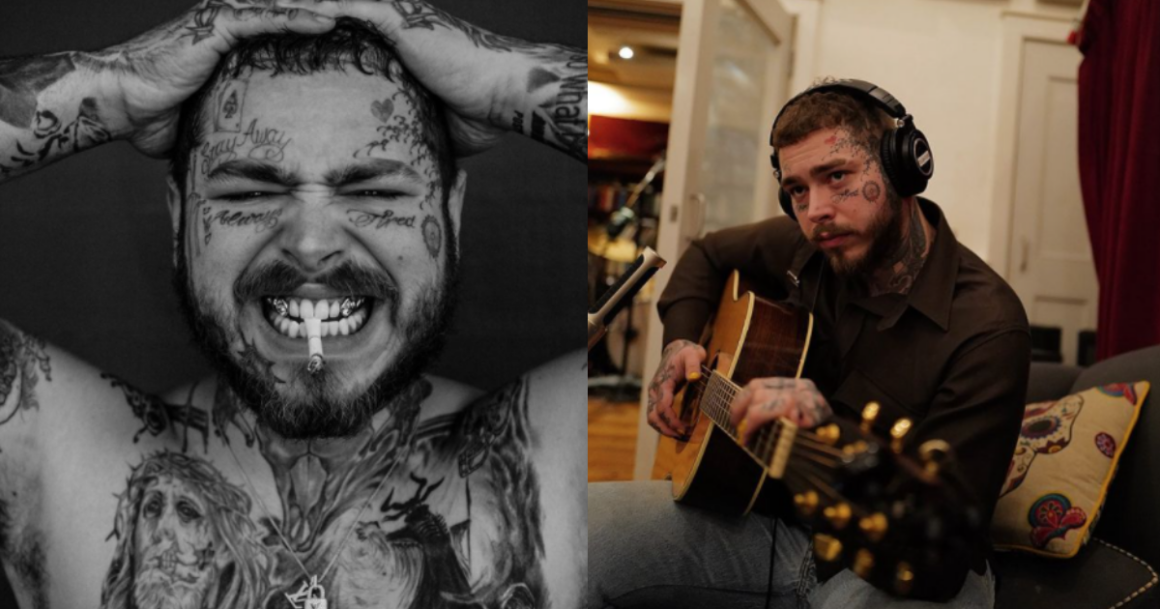 Check Out Post Malone's $1.6 Million Smile