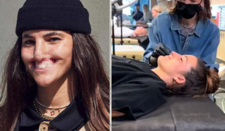 Model Brooklinn Khoury Prepares for Lip Tattoo Amid Reconstruction ...